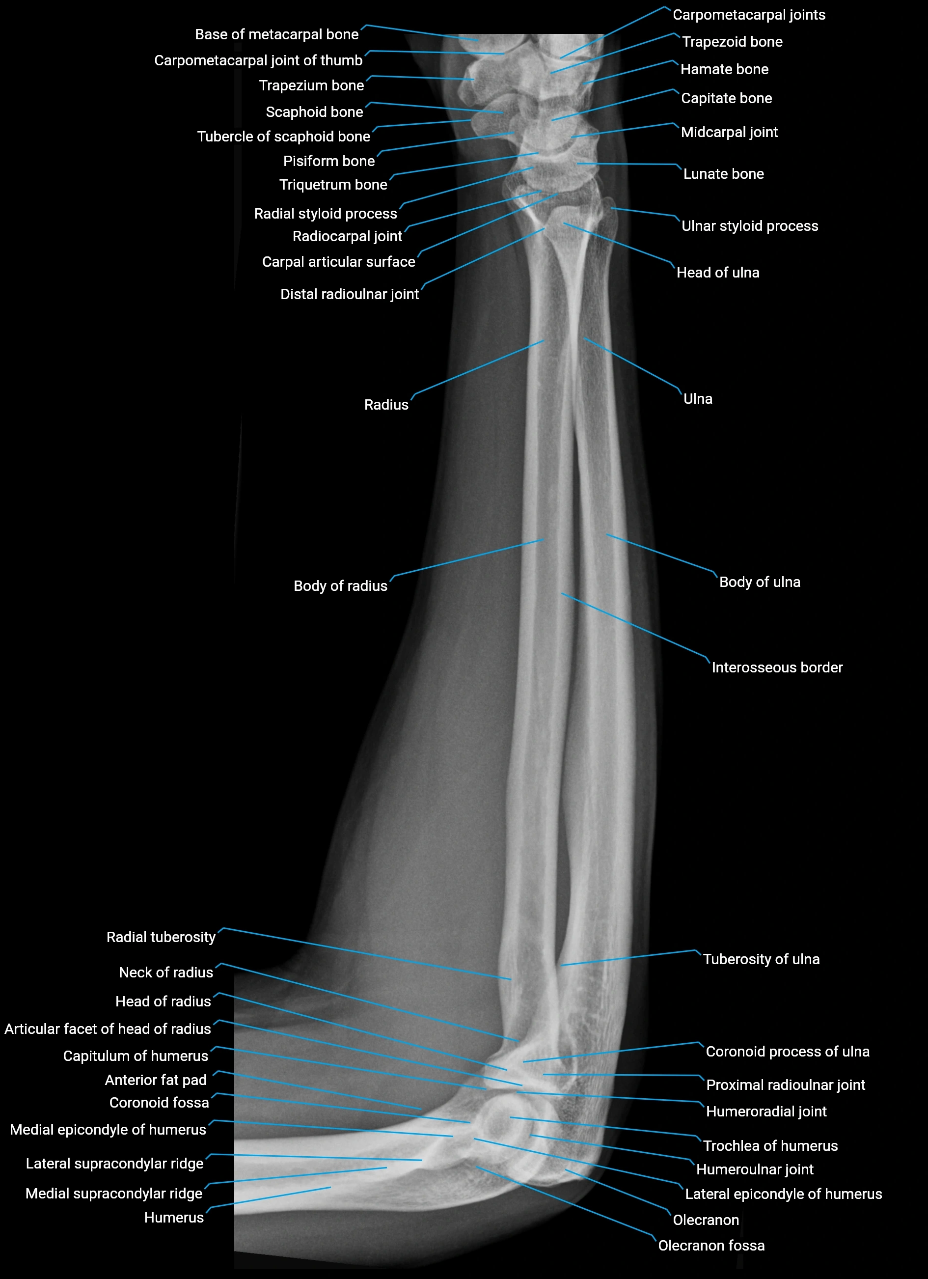 Forearm X-ray Anatomy – AP & Lateral View | Normal Labeled Radiographic ...