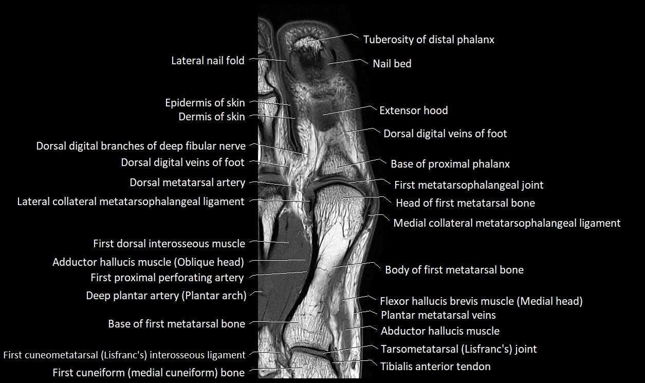 MRI Great Toe Anatomy – Labeled Axial, Coronal & Sagittal Cross-Sections