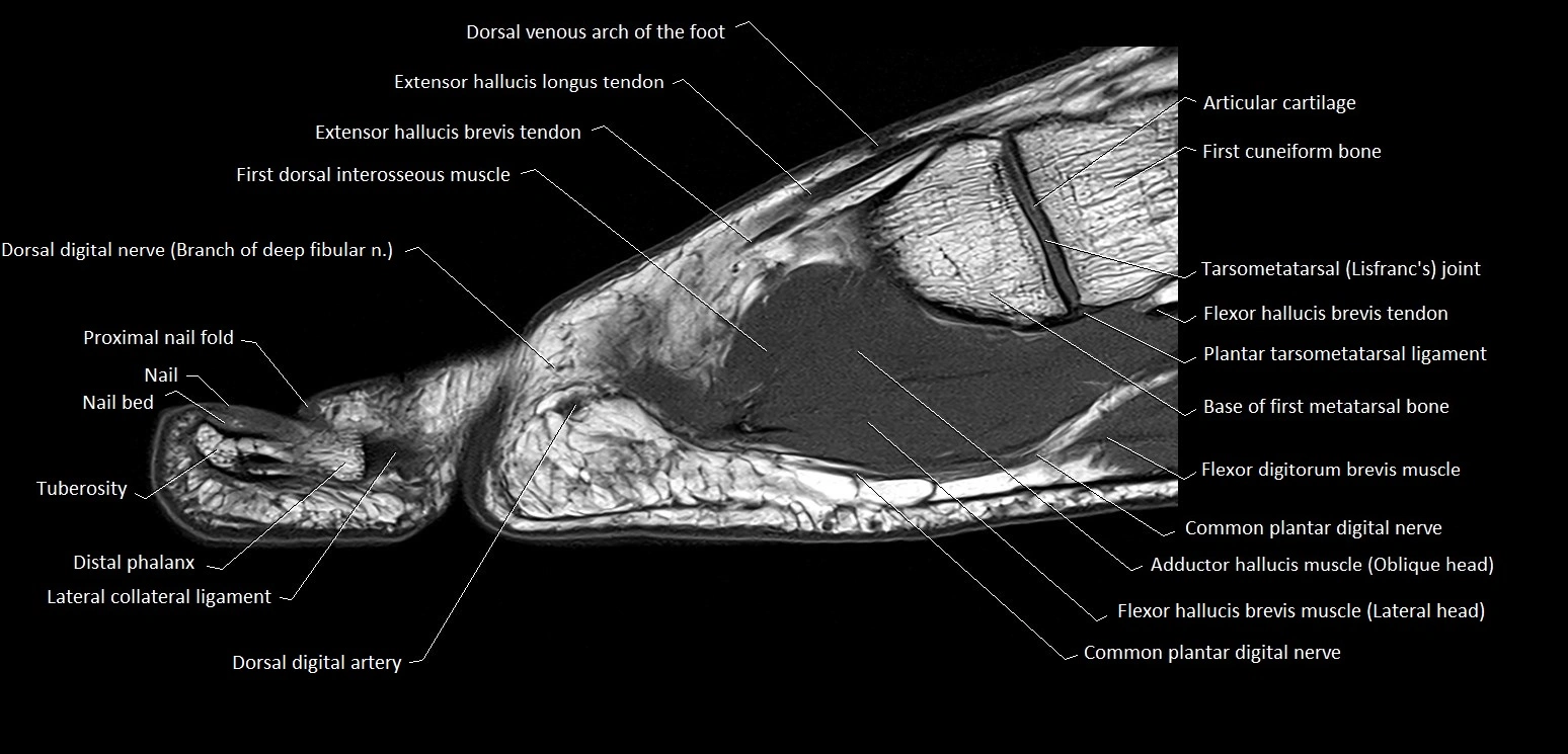 MRI Great Toe Anatomy – Labeled Axial, Coronal & Sagittal Cross-Sections