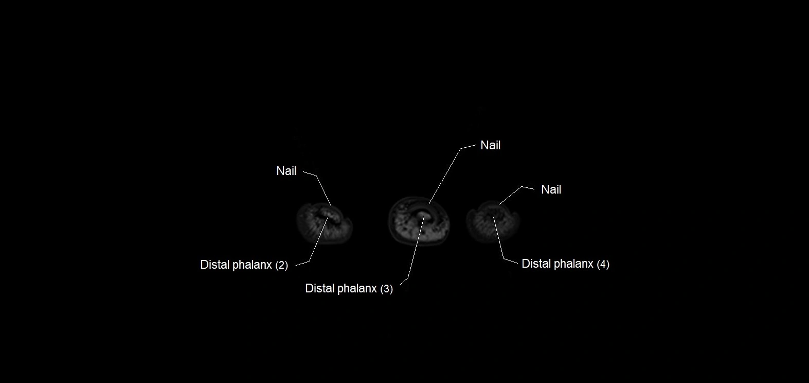 MRI Hand Anatomy – Labeled Axial, Coronal & Sagittal Images
